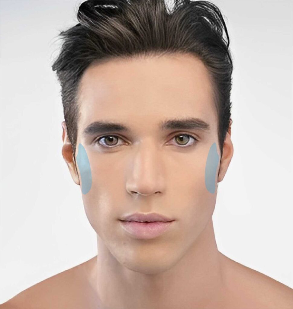 Depilación de Patillas para Hombre | Derma&Plastic | Talca