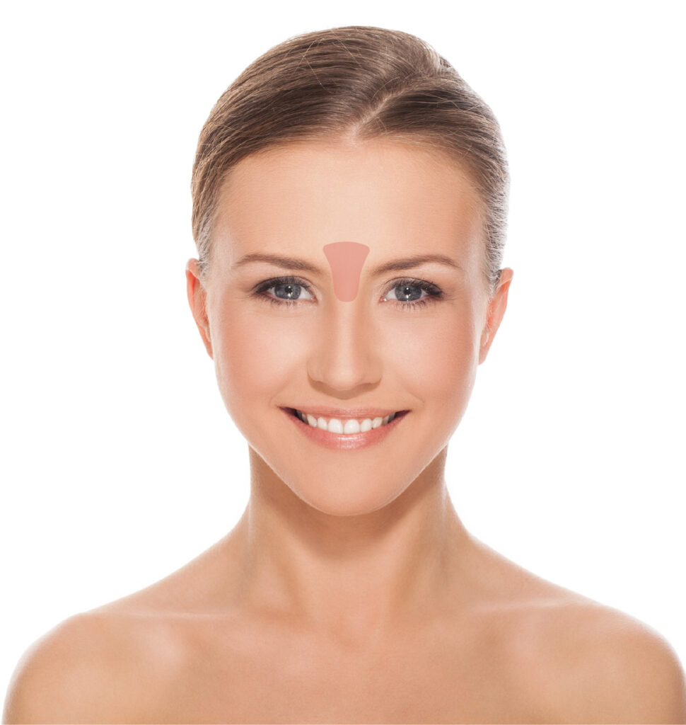 Depilación de Entrecejo para Mujer | Derma&Plastic | Talca